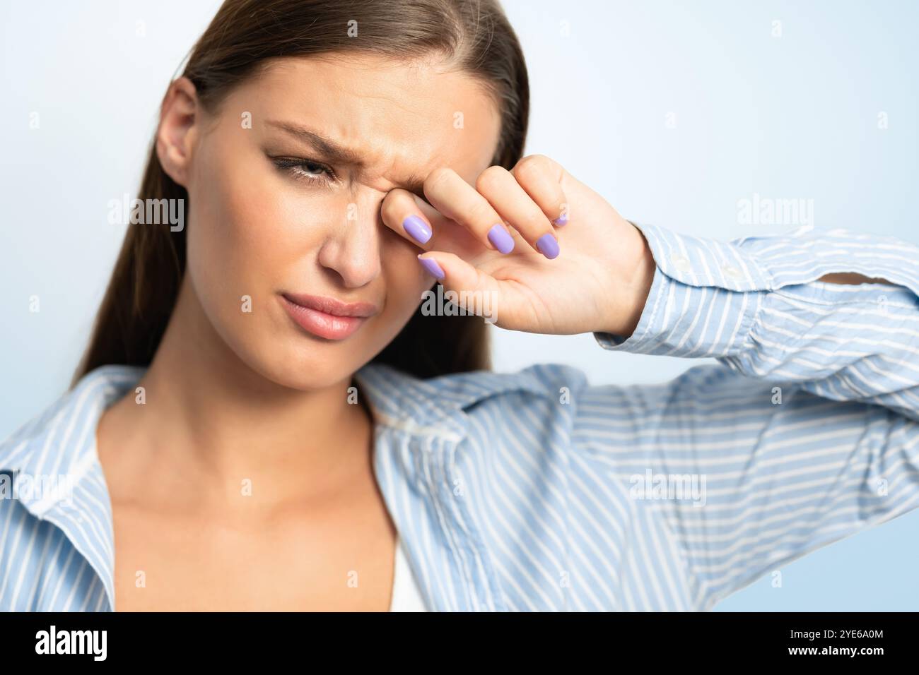 Woman Touching Aching Eye Standing On White Background, Studio Shot ...