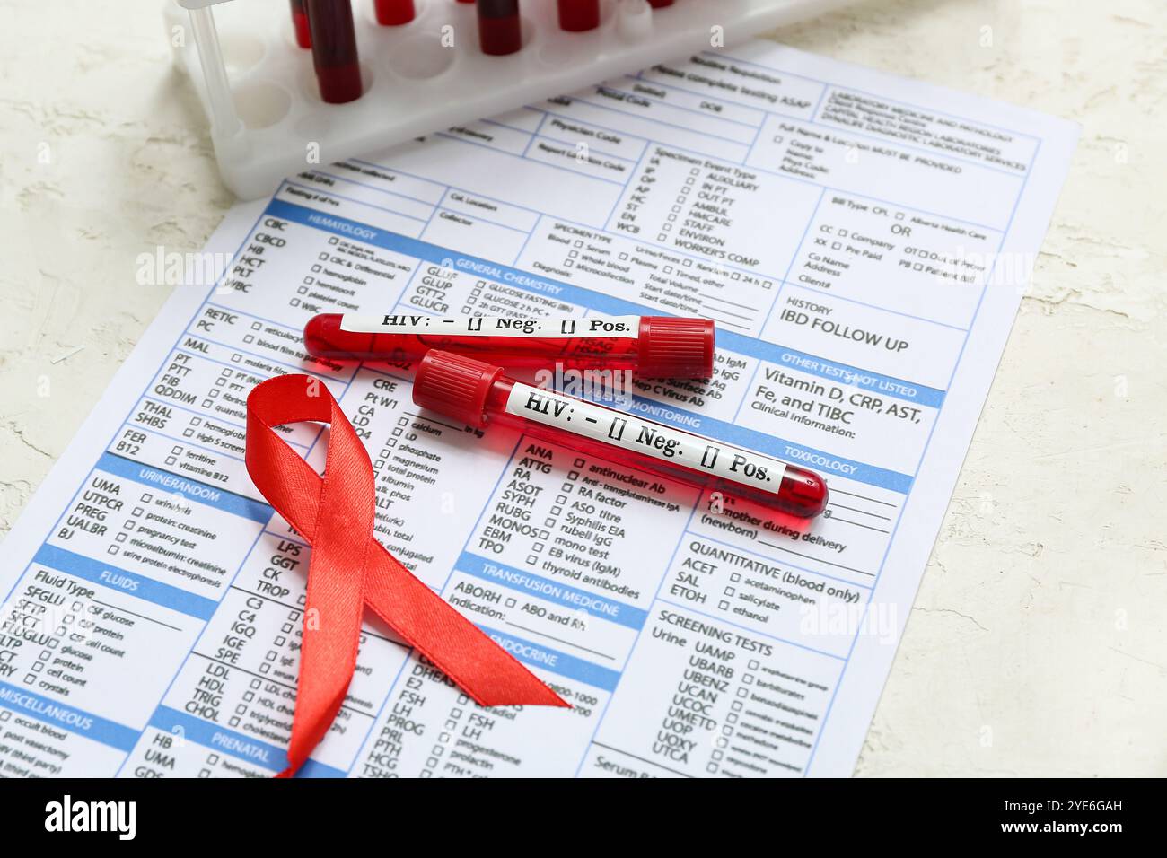 HIV blood test tubes, laboratory report form and red ribbon on white ...