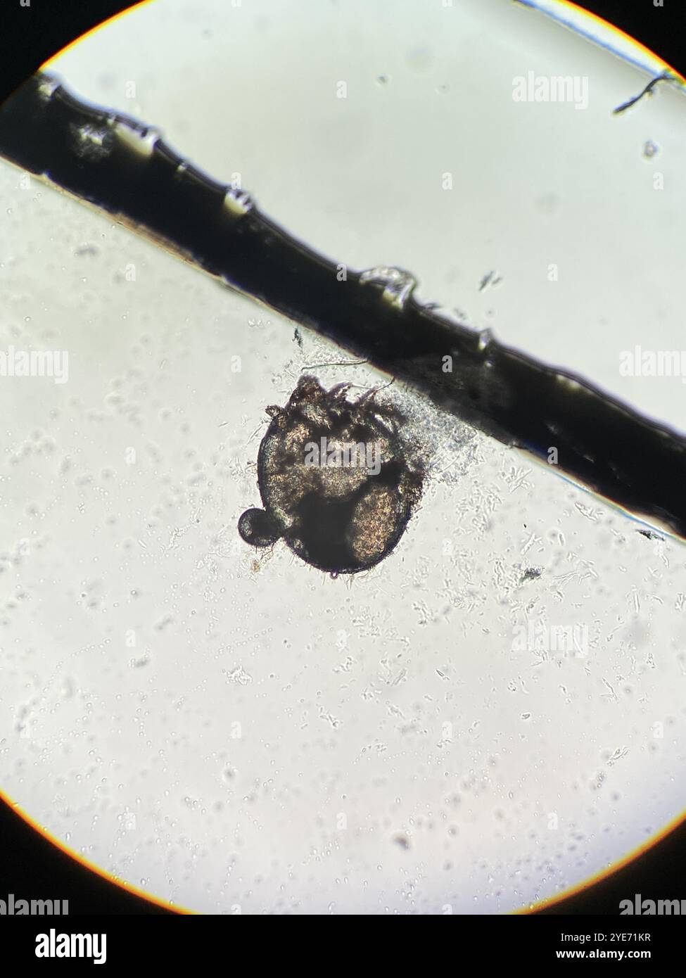 Dermatoscope image of a scabies mite (Sarcoptes scabiei). The scabies ...