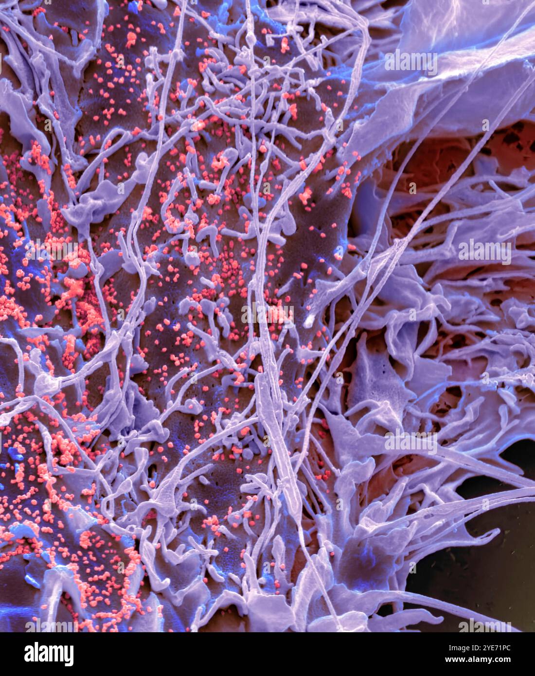 MERS. Coloured scanning electron micrograph (SEM). Viral particles (red ...