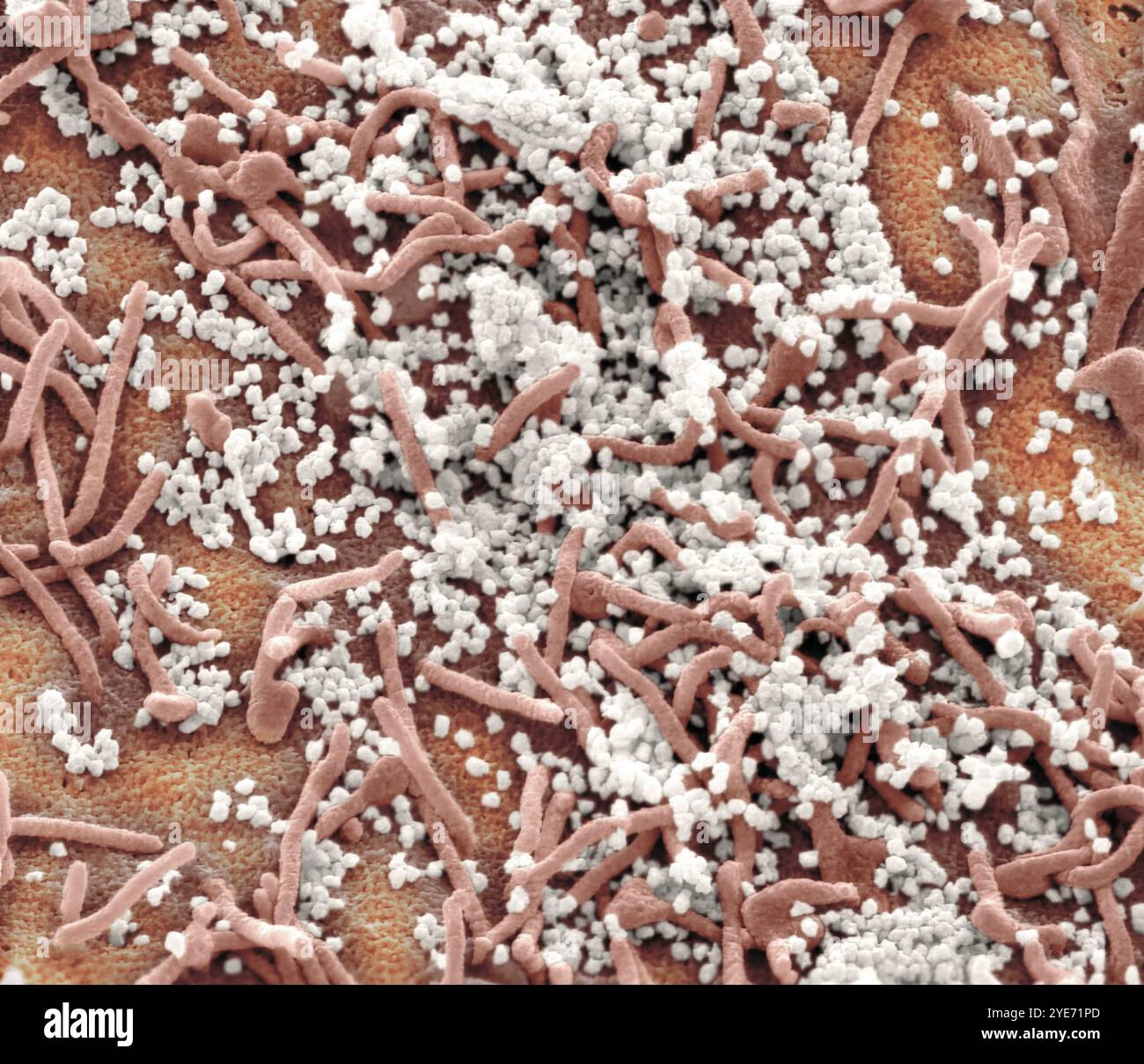 MERS. Coloured scanning electron micrograph (SEM). Viral particles ...