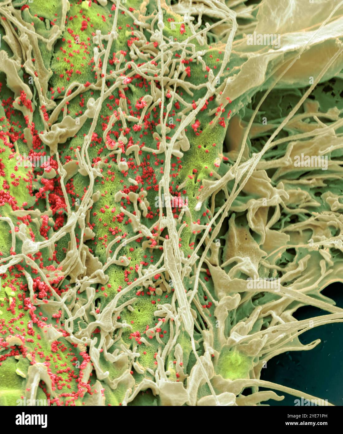 MERS. Coloured scanning electron micrograph (SEM). Viral particles (red ...