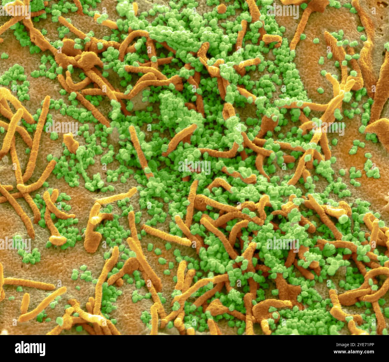 MERS. Coloured scanning electron micrograph (SEM). Viral particles ...