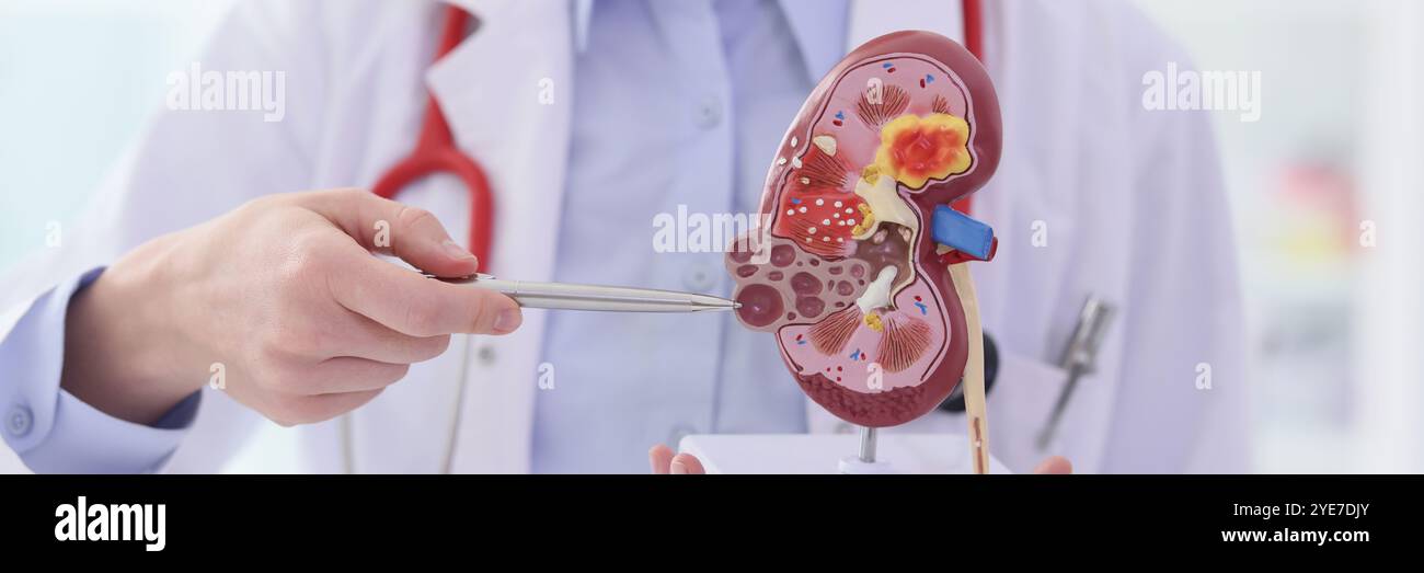 Doctor points pen to artificial model of kidney at lesson Stock Photo ...
