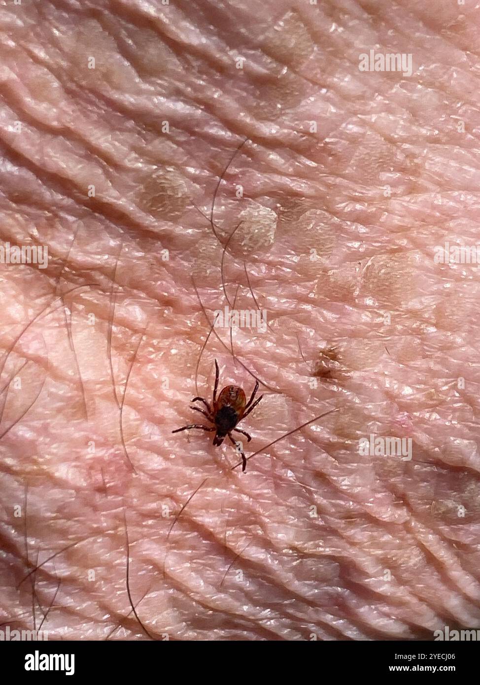 Eastern Black-legged Tick (Ixodes scapularis Stock Photo - Alamy