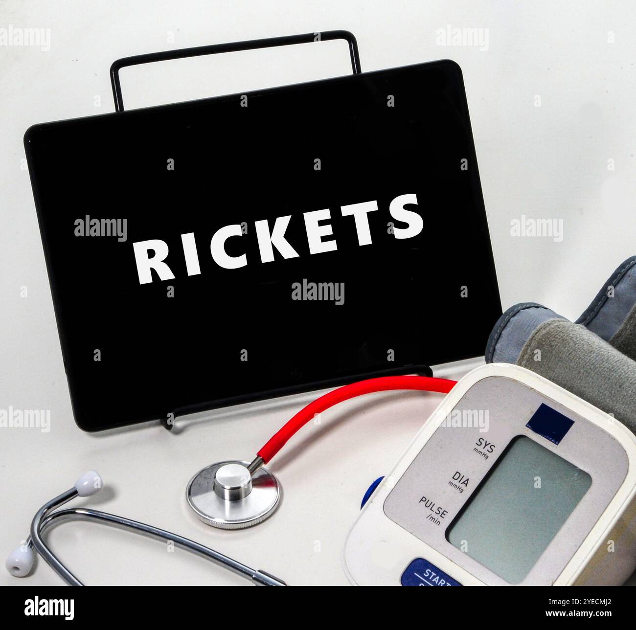 Rickets disease hi-res stock photography and images - Alamy