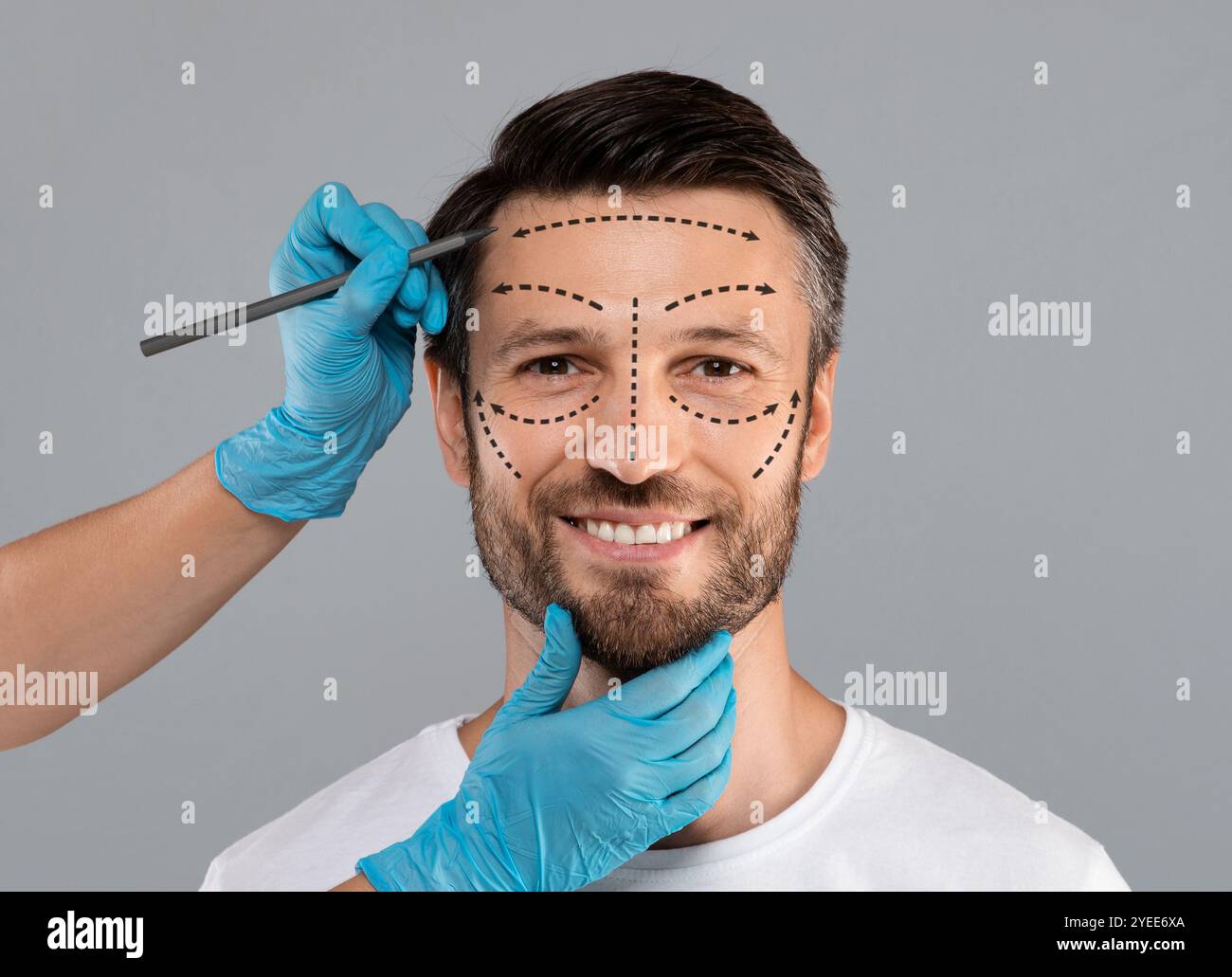 Surgeon hands making marks on smiling man face Stock Photo - Alamy