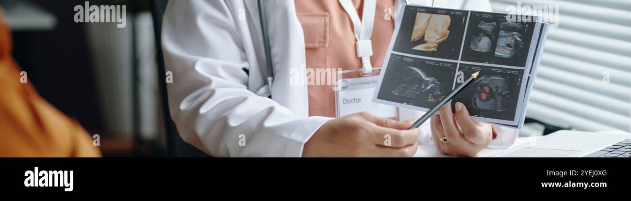 Reviewing ultrasound hi-res stock photography and images - Alamy