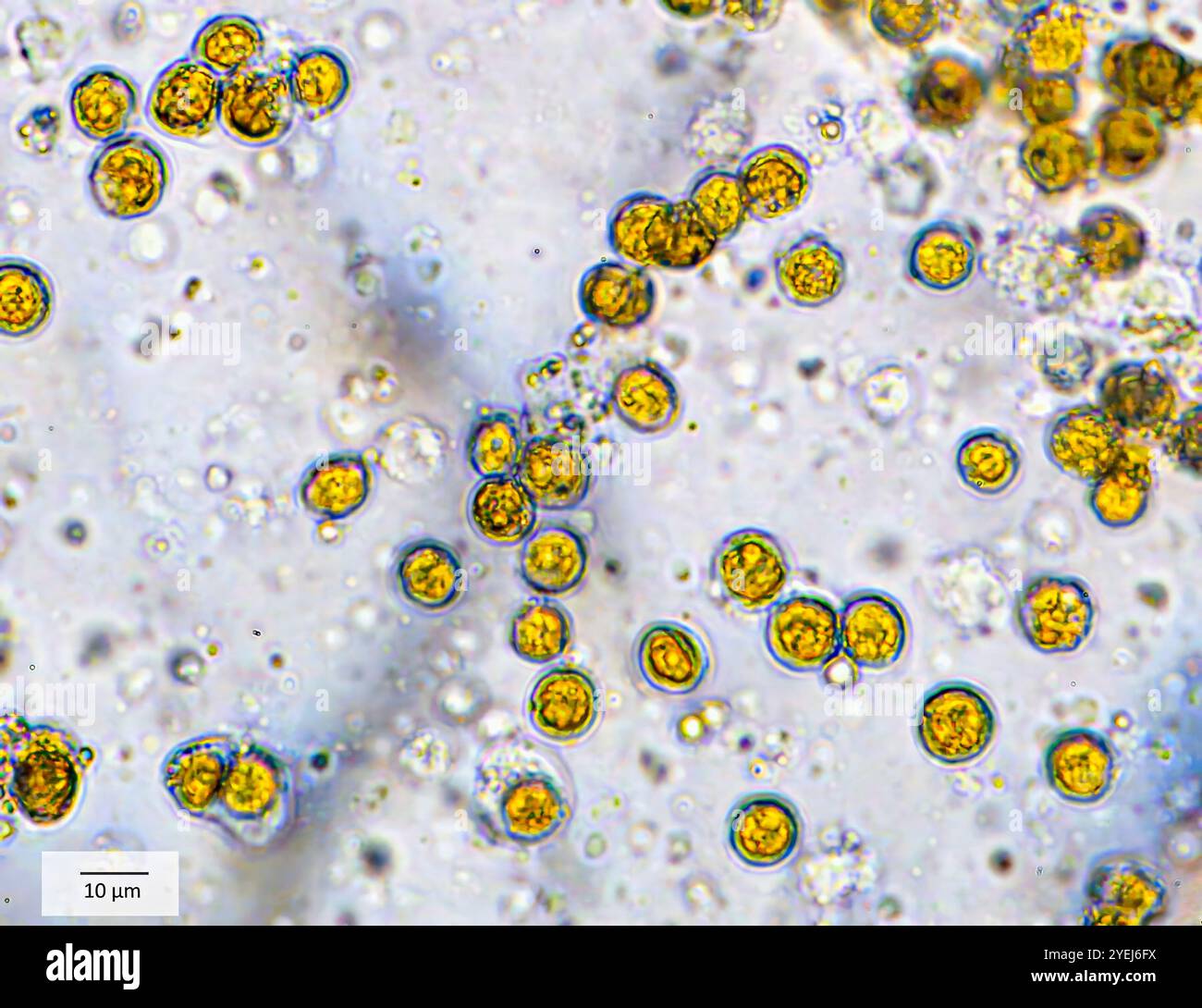 Symbiodinium hi-res stock photography and images - Alamy