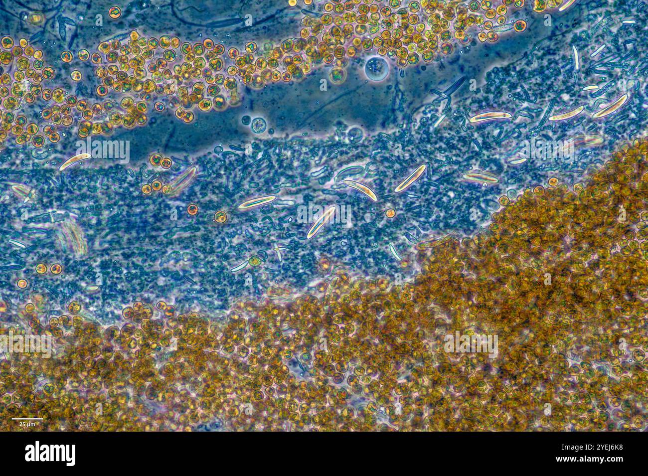 Symbiotic algae (zooxanthellae) and stinging cells from Aiptasia sp ...