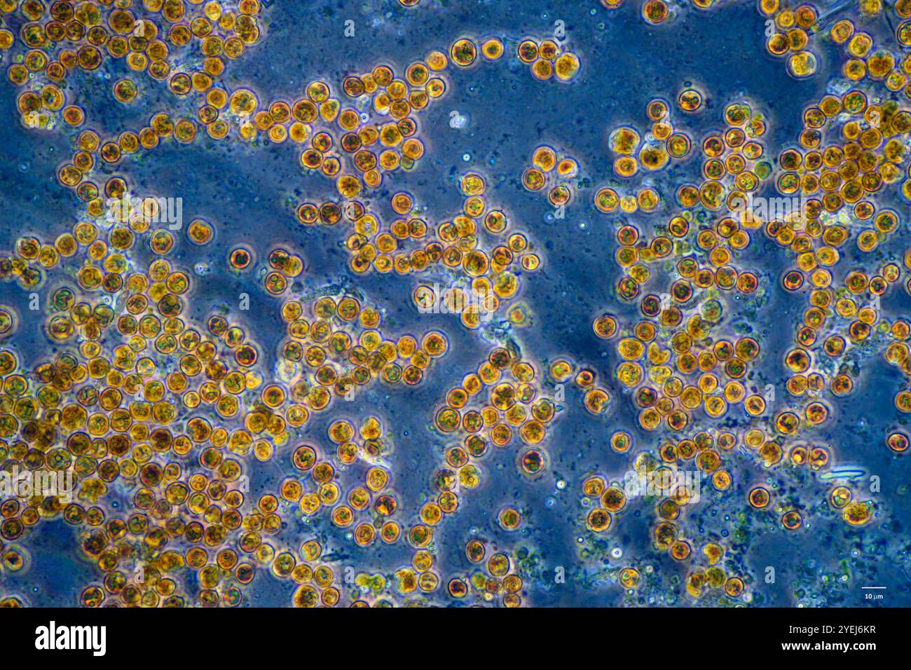 Symbiotic algae (zooxanthellae) from Aiptasia sp., probably belonging ...