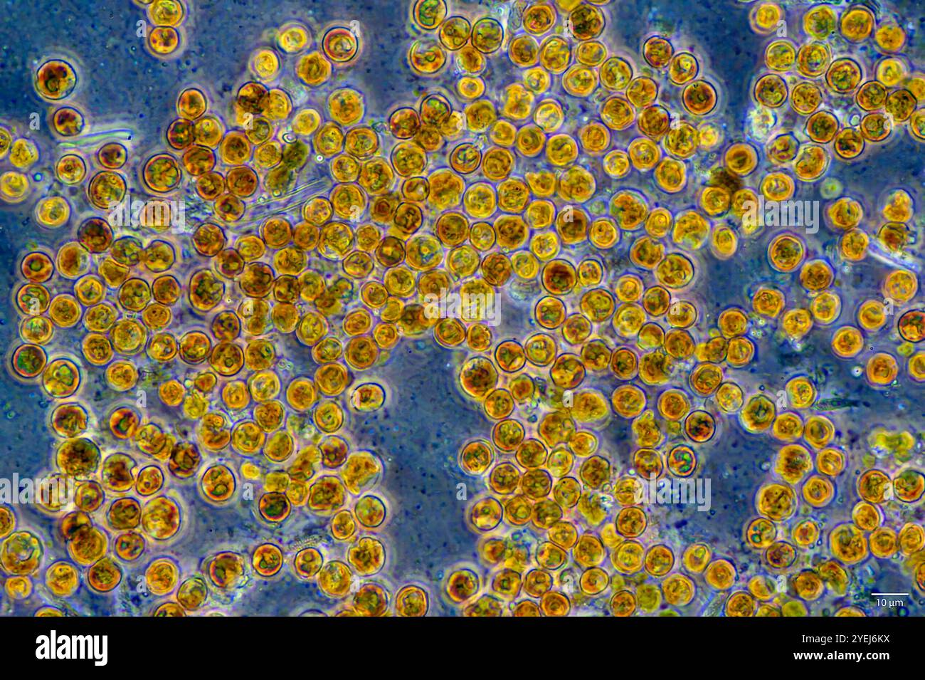 Symbiotic algae (zooxanthellae) from Aiptasia sp., probably belonging ...