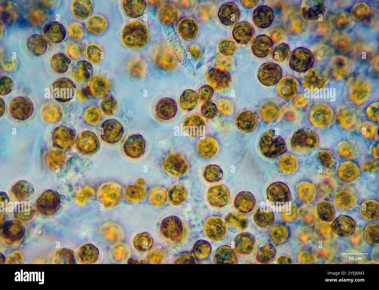 Symbiotic algae (zooxanthellae) from Aiptasia sp., probably belonging ...