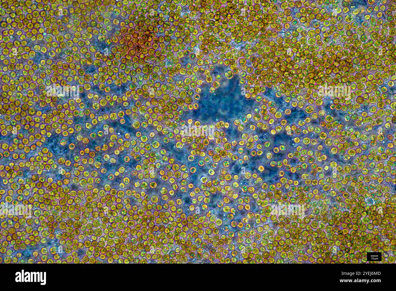 Symbiotic algae (zooxanthellae) from Aiptasia sp., probably belonging ...