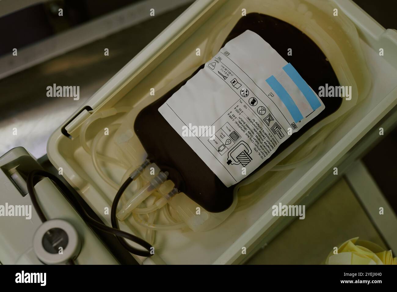 Close-up image showing filled blood donation bag with attached tubes ...