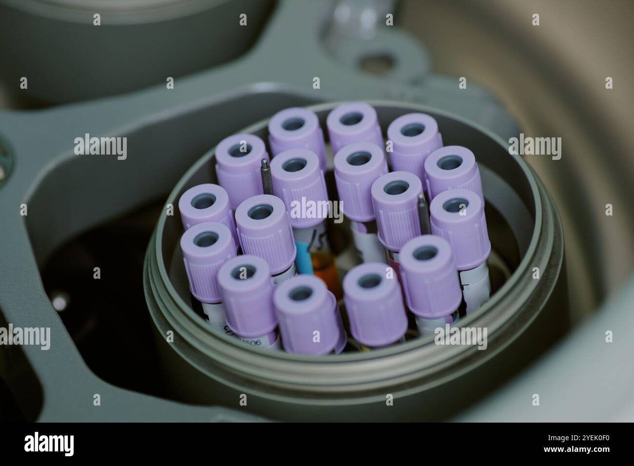 Close-up of laboratory blood sample tubes with purple caps placed in a ...
