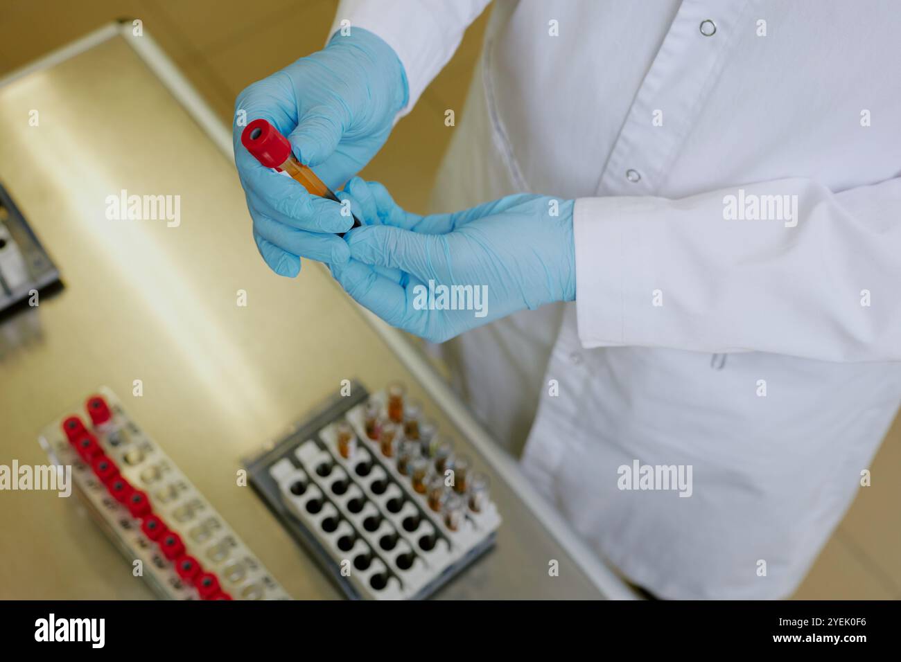 Laboratory technician holding a tube with blood sample in gloved hands ...