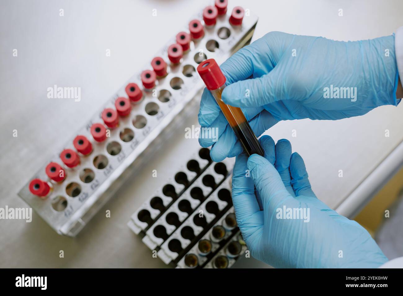 Gloved hands holding blood sample vial while conducting analysis in ...