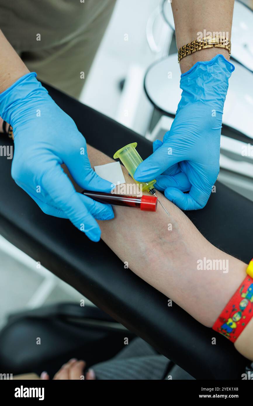 A nurse doctor collects blood from a patient's vein. Taking blood from ...