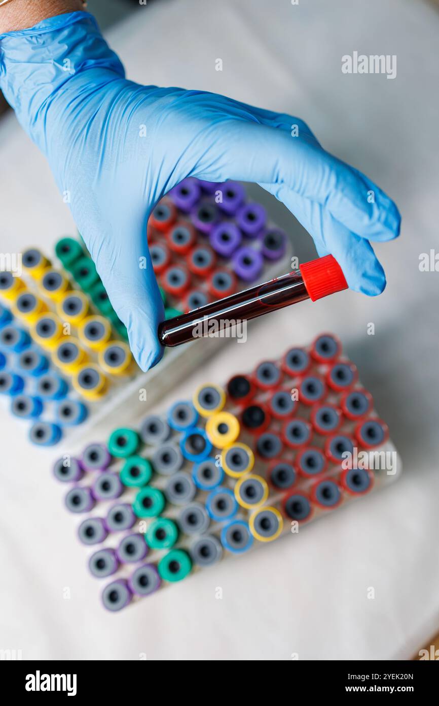 Test tubes with blood. Taking blood from a vein for research Stock ...