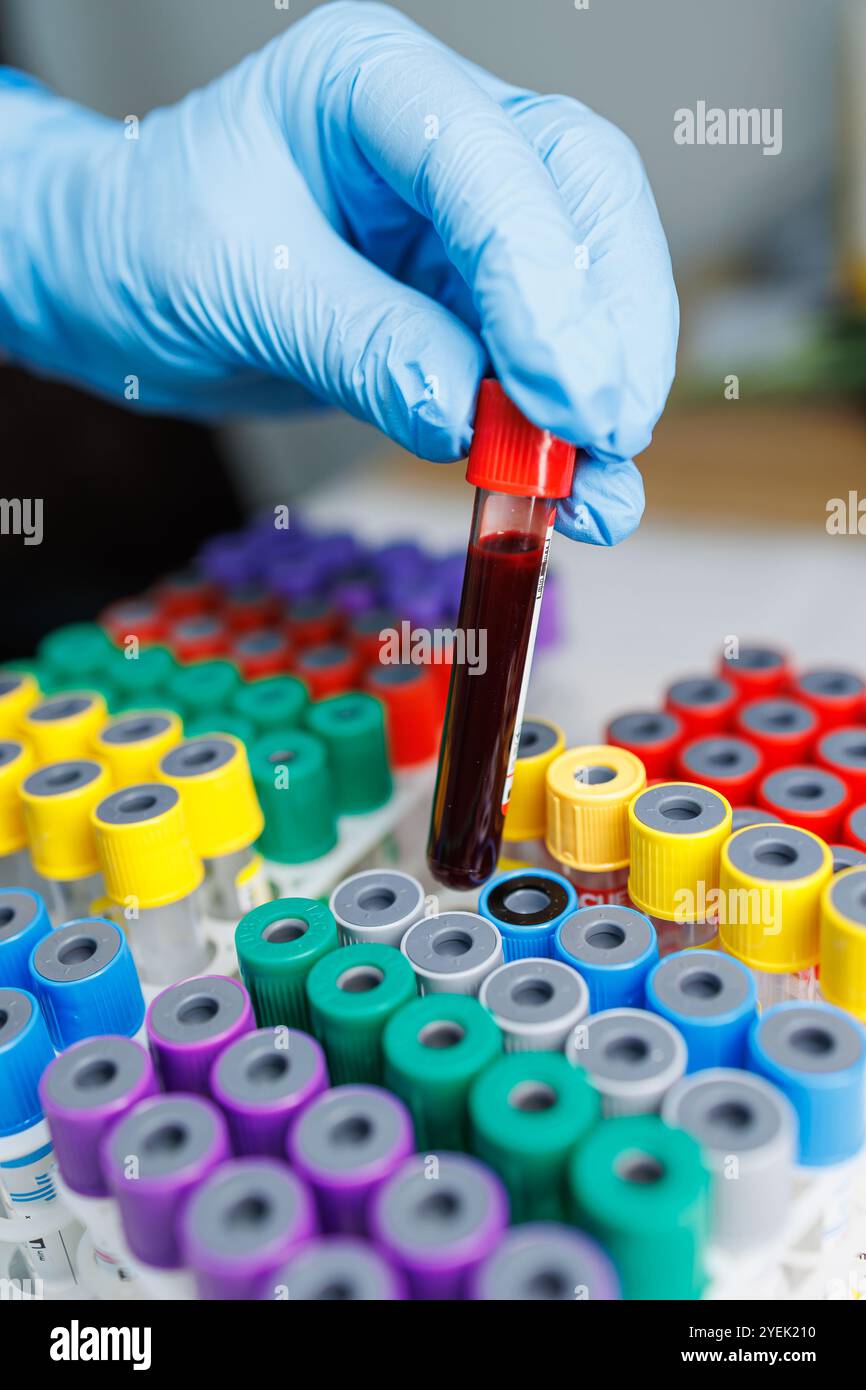 Test tubes with blood. Taking blood from a vein for research Stock ...