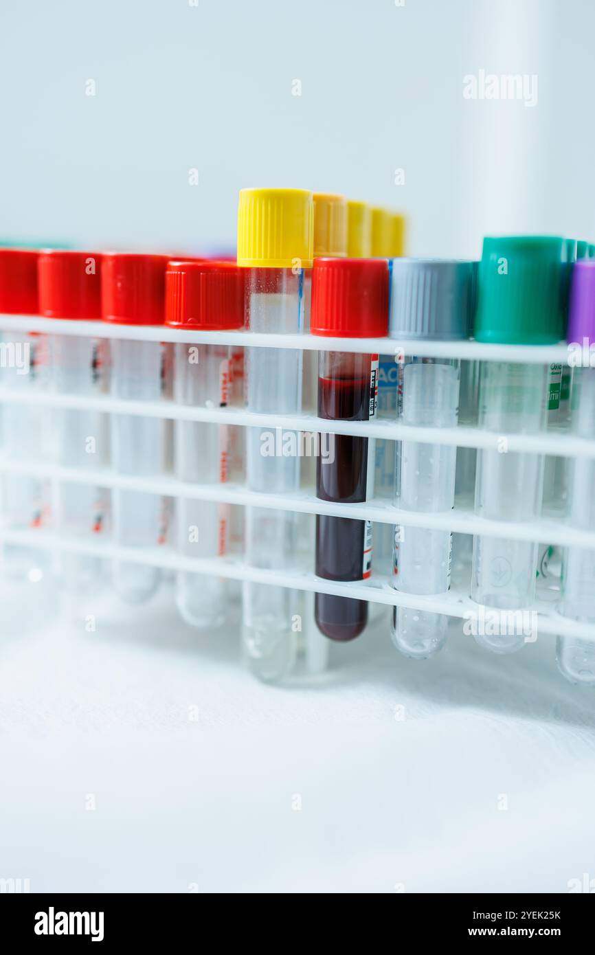Test tubes with blood. Taking blood from a vein for research Stock ...
