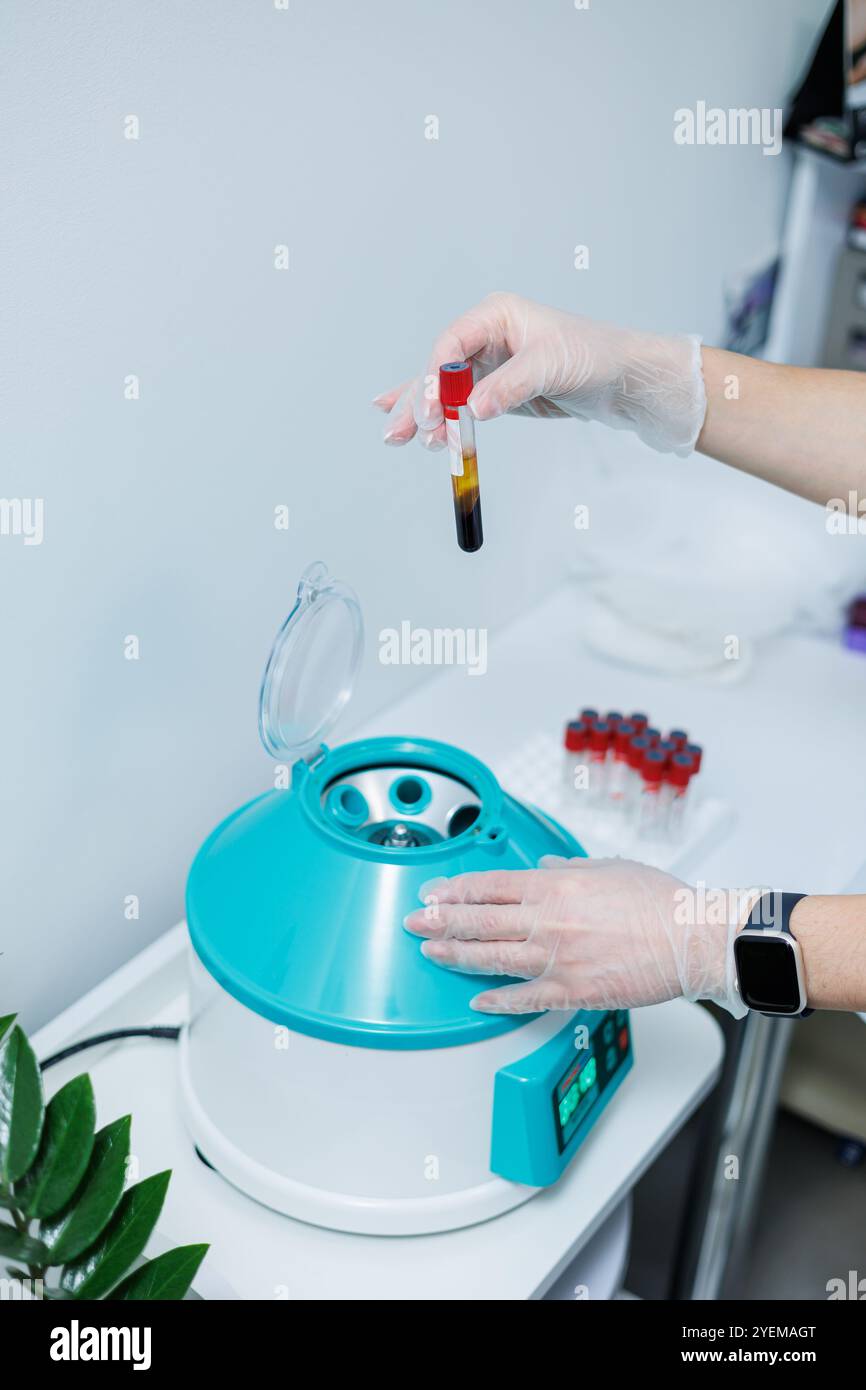 The blood in the test tube is placed in a centrifuge for plasma therapy ...