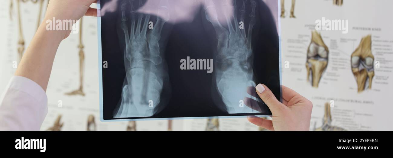 Doctor holds X-ray picture of patient feet in hospital Stock Photo - Alamy