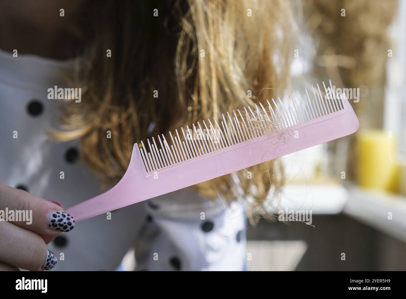 Worried woman holding brush with hair loss after brushing. Clump of ...