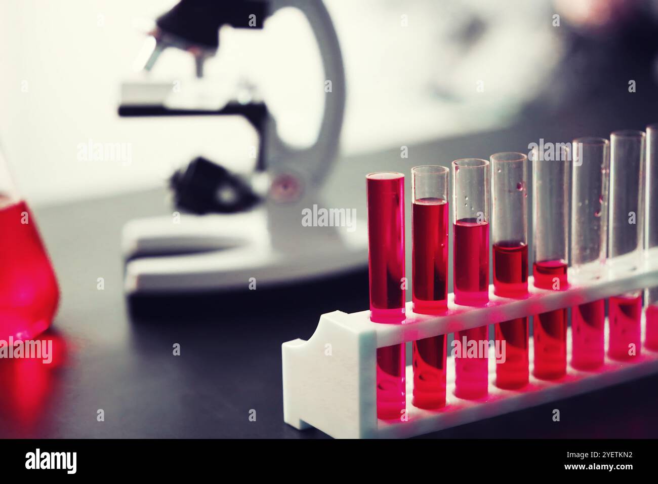 Test tube with blue liquid on laboratory table. Examination of liquid ...