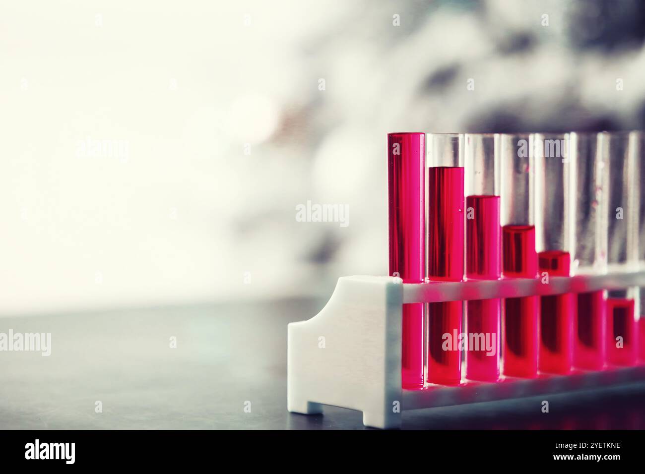 Test tube with blue liquid on laboratory table. Examination of liquid ...