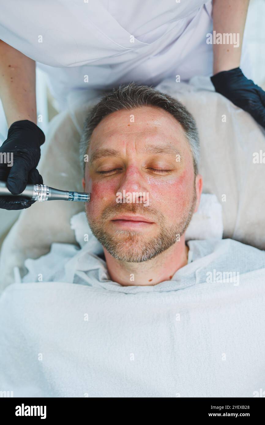 Male cosmetology. A man lies at a cosmetologist for a facial treatment ...