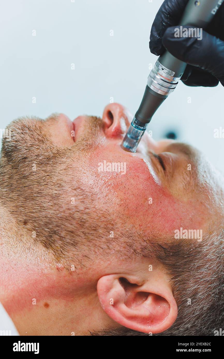 Male cosmetology. A man lies at a cosmetologist for a facial treatment ...