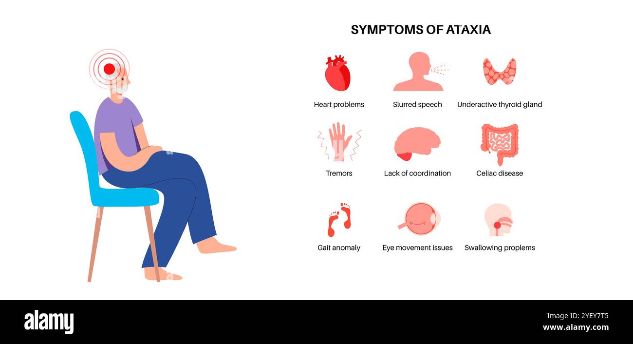 Conceptual illustration of cerebellar ataxia. Ataxia is disorder that ...
