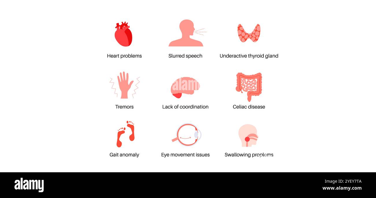 Conceptual illustration of cerebellar ataxia. Ataxia is disorder that ...