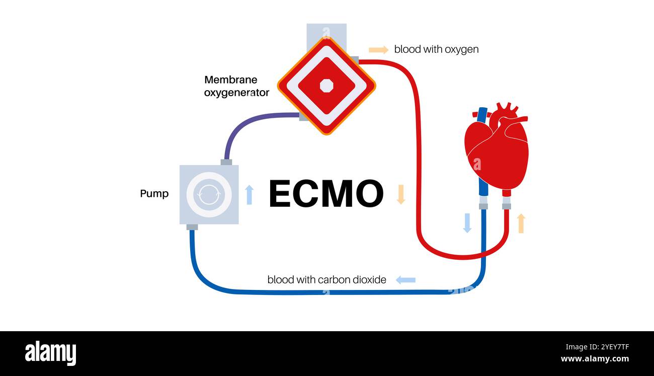Venoarterial hi-res stock photography and images - Alamy