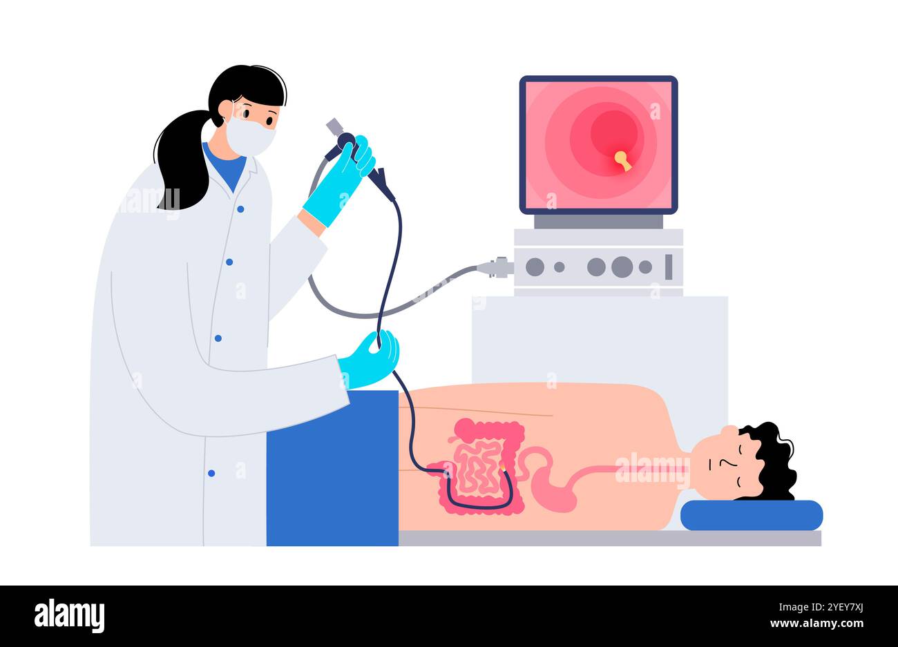 Conceptual illustration of a colonoscopy procedure. This is an ...