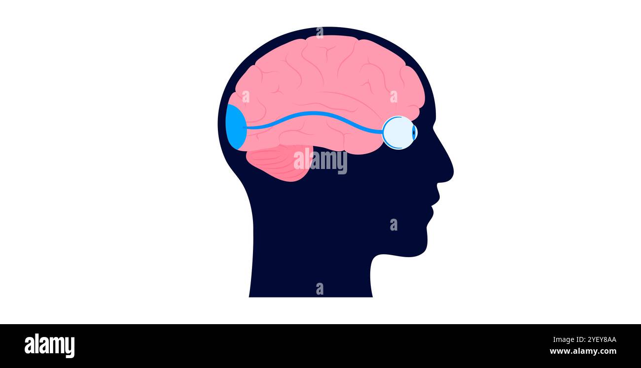 Illustration of the optic nerve anatomy. The optic nerves send visual ...