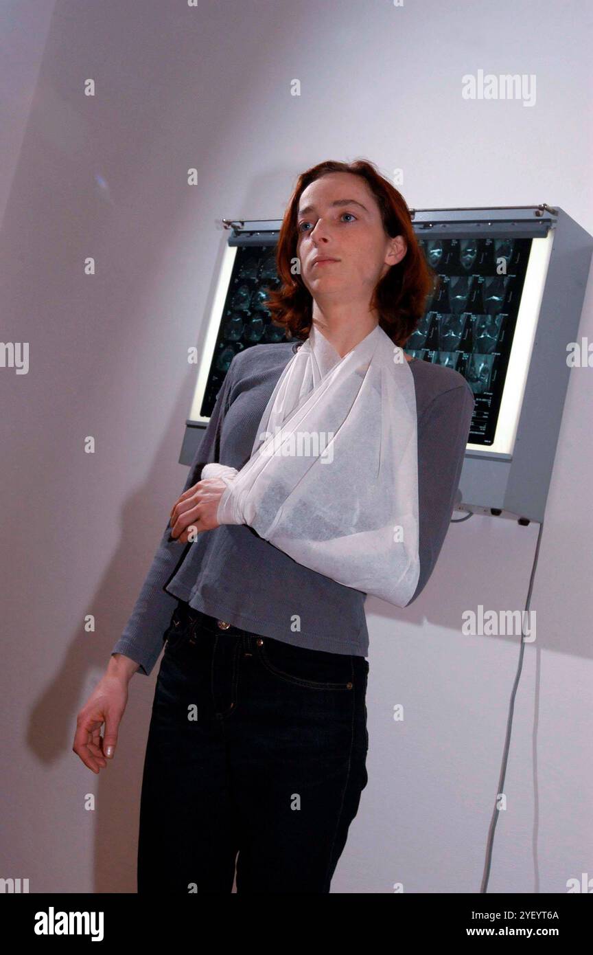 arm injury after an accident, injured part of the body arm injury after ...