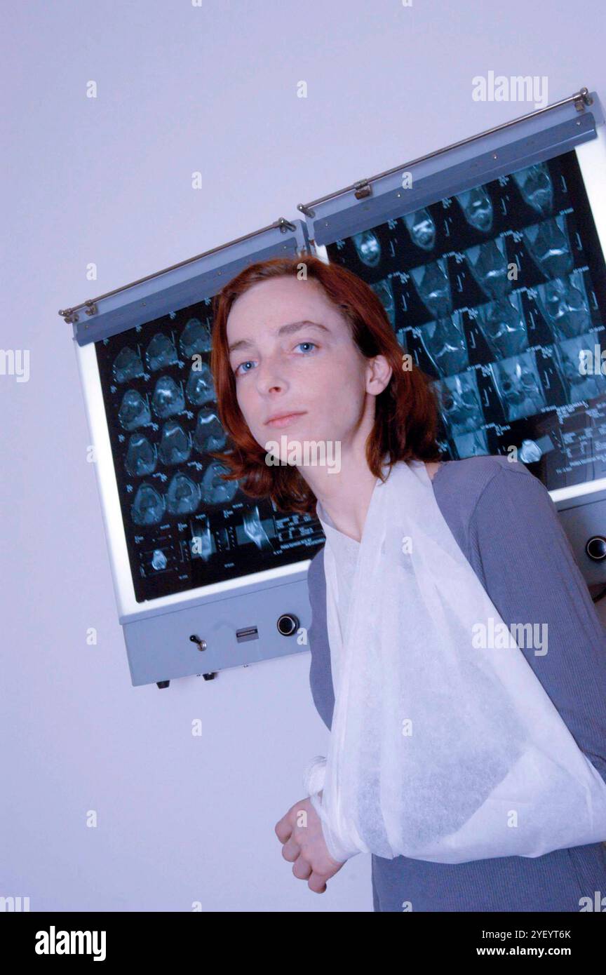 arm injury after an accident, injured part of the body arm injury after ...