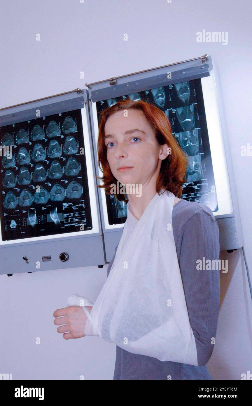 arm injury after an accident, injured part of the body arm injury after ...