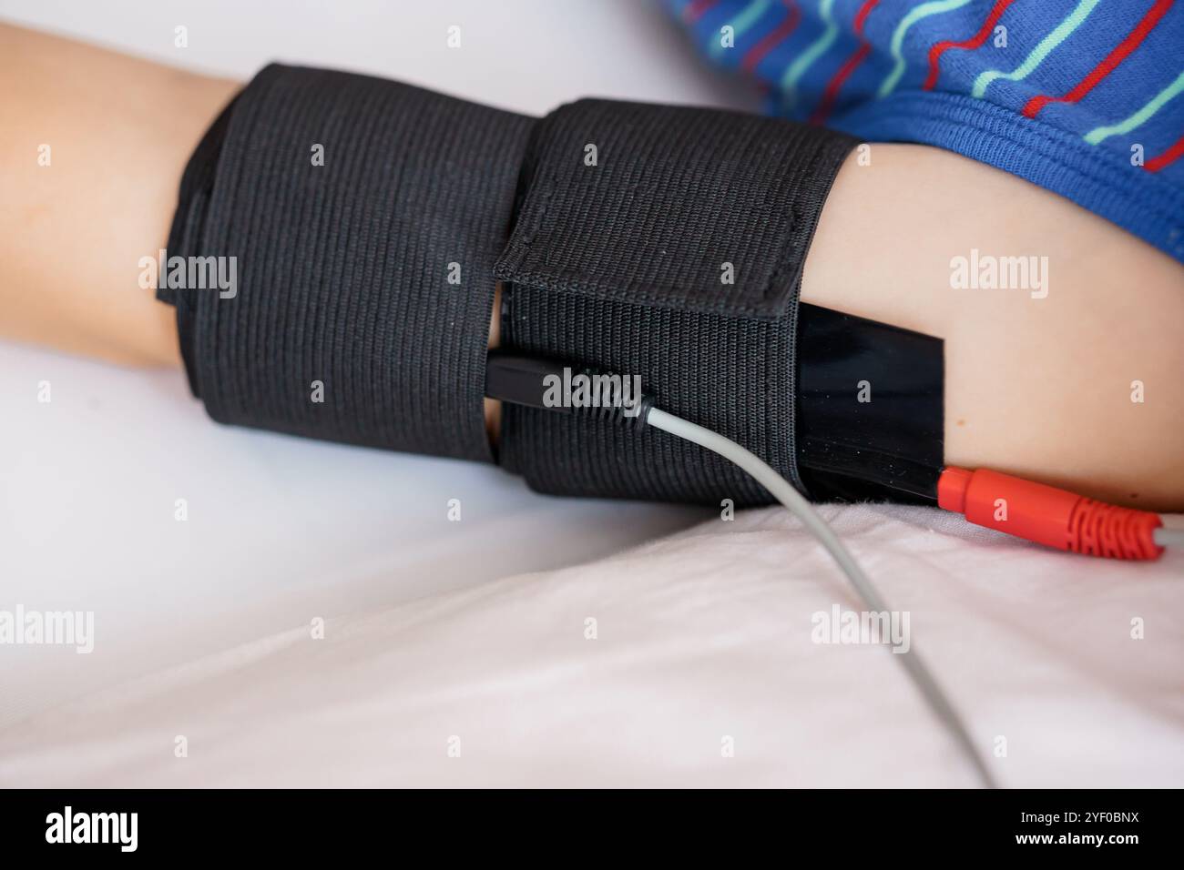 Child injury arm hi-res stock photography and images - Alamy