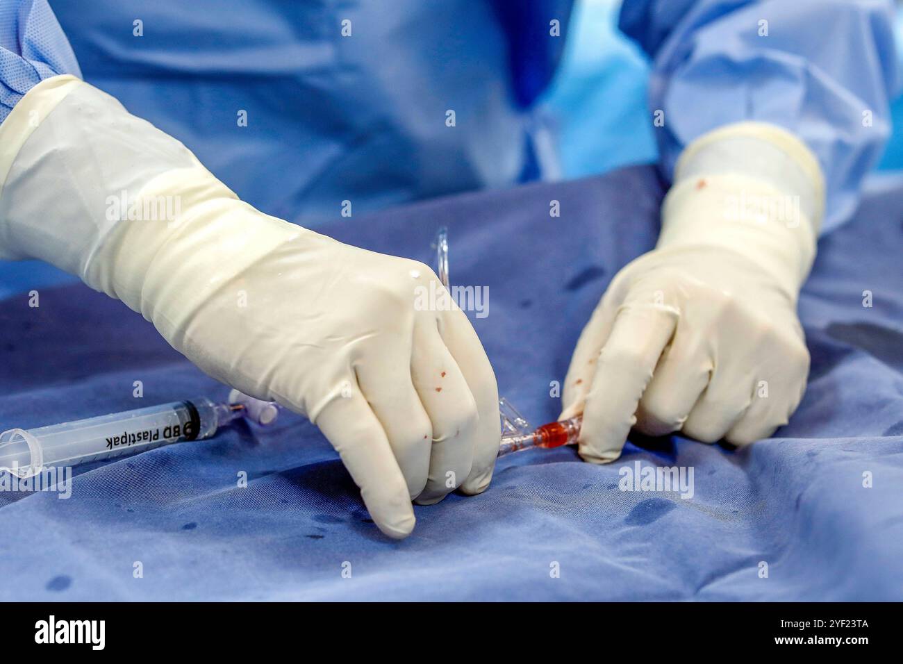 Cardiac surgery at Hotel Dieu de France hospital in Beirut, Lebanon ...