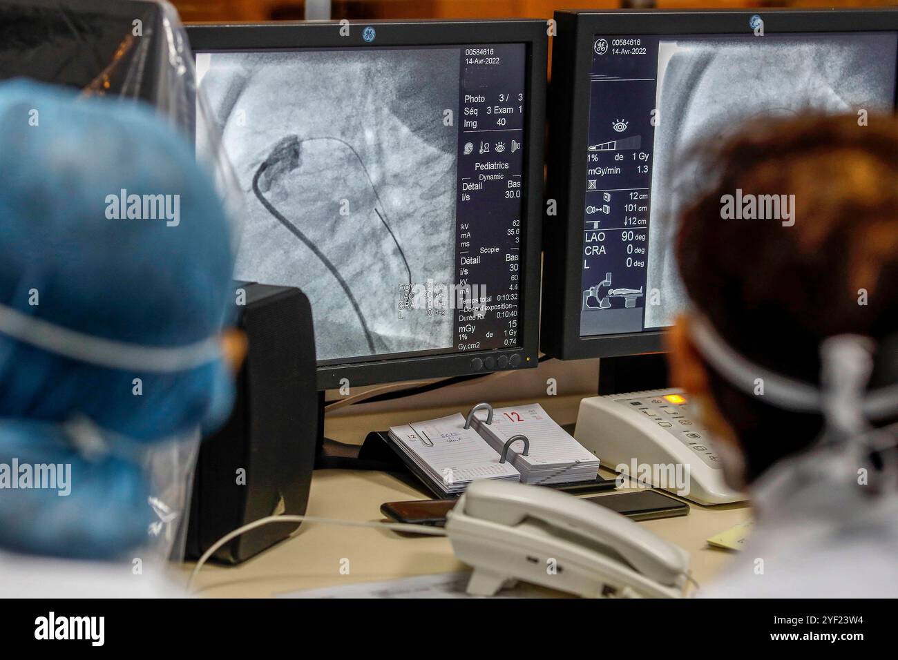 Cardiac surgery at Hotel Dieu de France hospital in Beirut, Lebanon ...