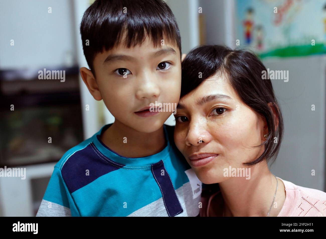 Congenital heart disease children hi-res stock photography and images ...