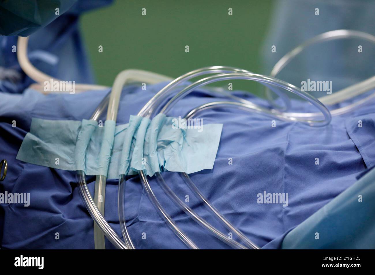 Cardiology Hospital. Operating theater. Cardiac surgery. Ho Chi Minh ...