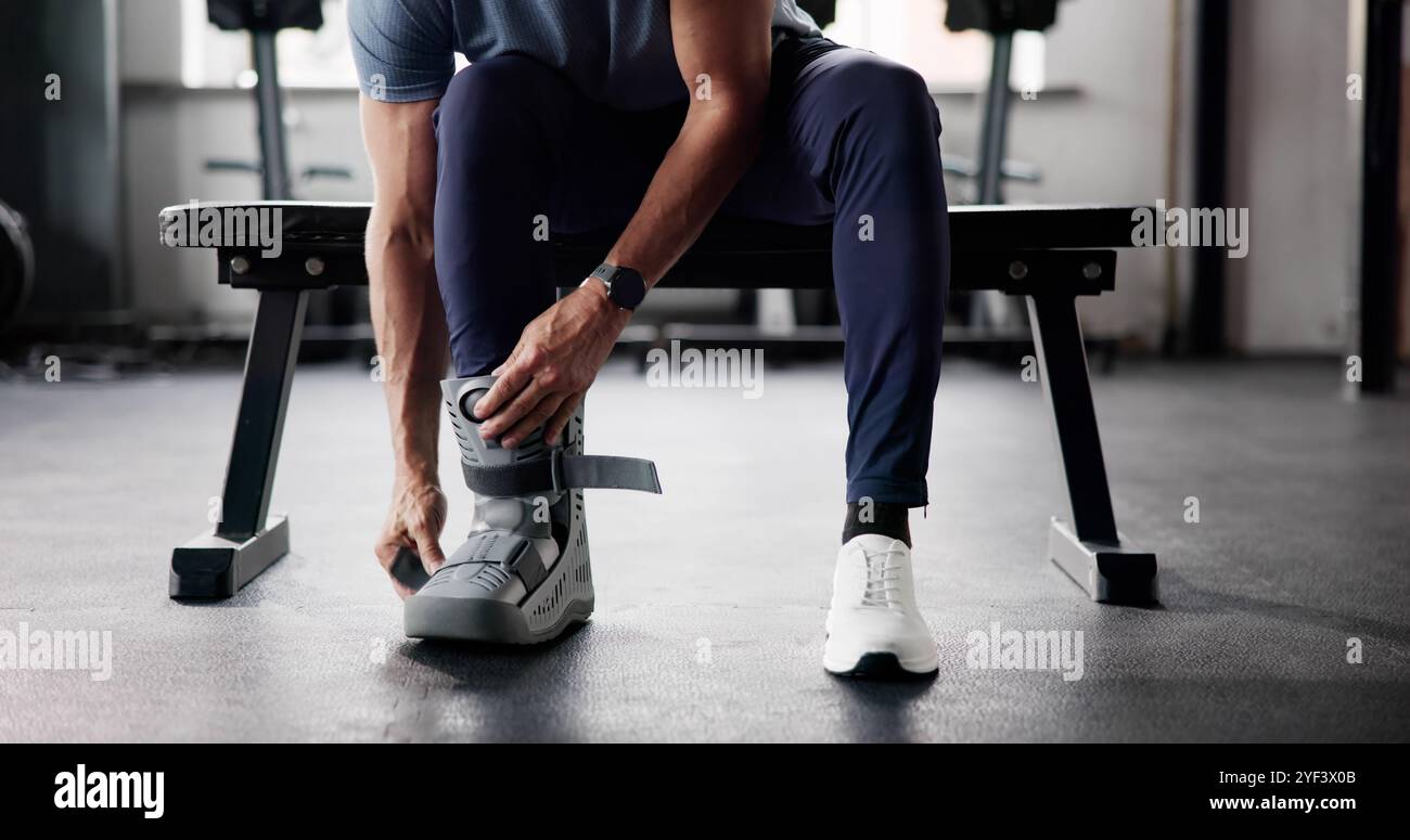 Broken Foot Leg Injury. Bone Fracture Treatment Stock Photo - Alamy