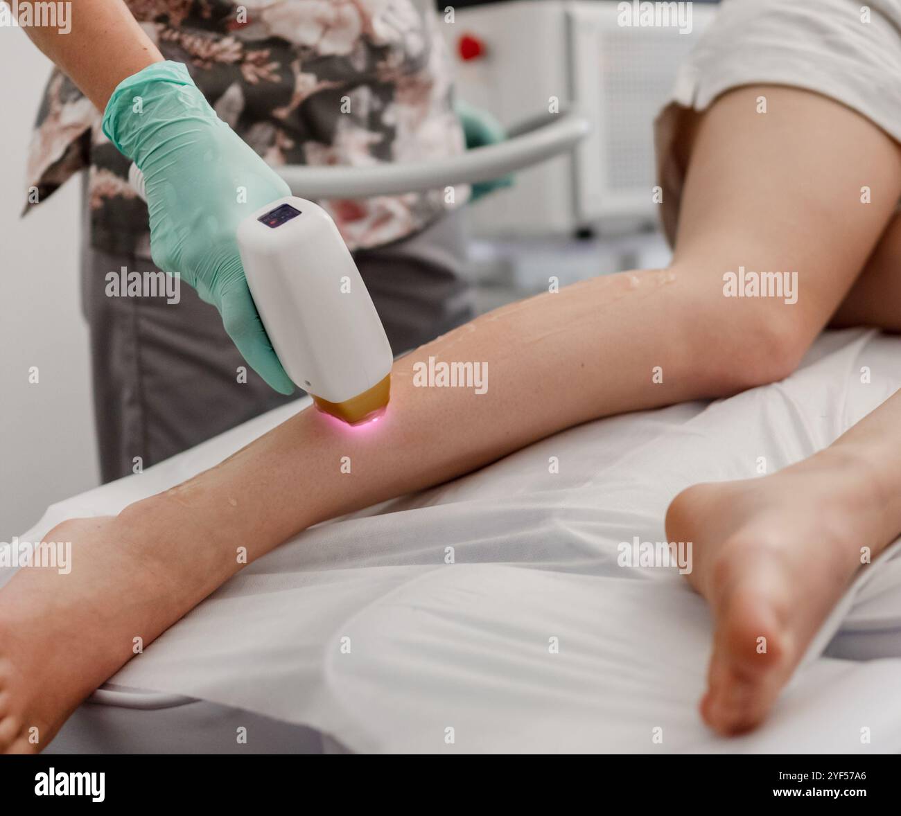 Master Of Laser Hair Removal Performs Procedure In Close-Up Stock Photo ...