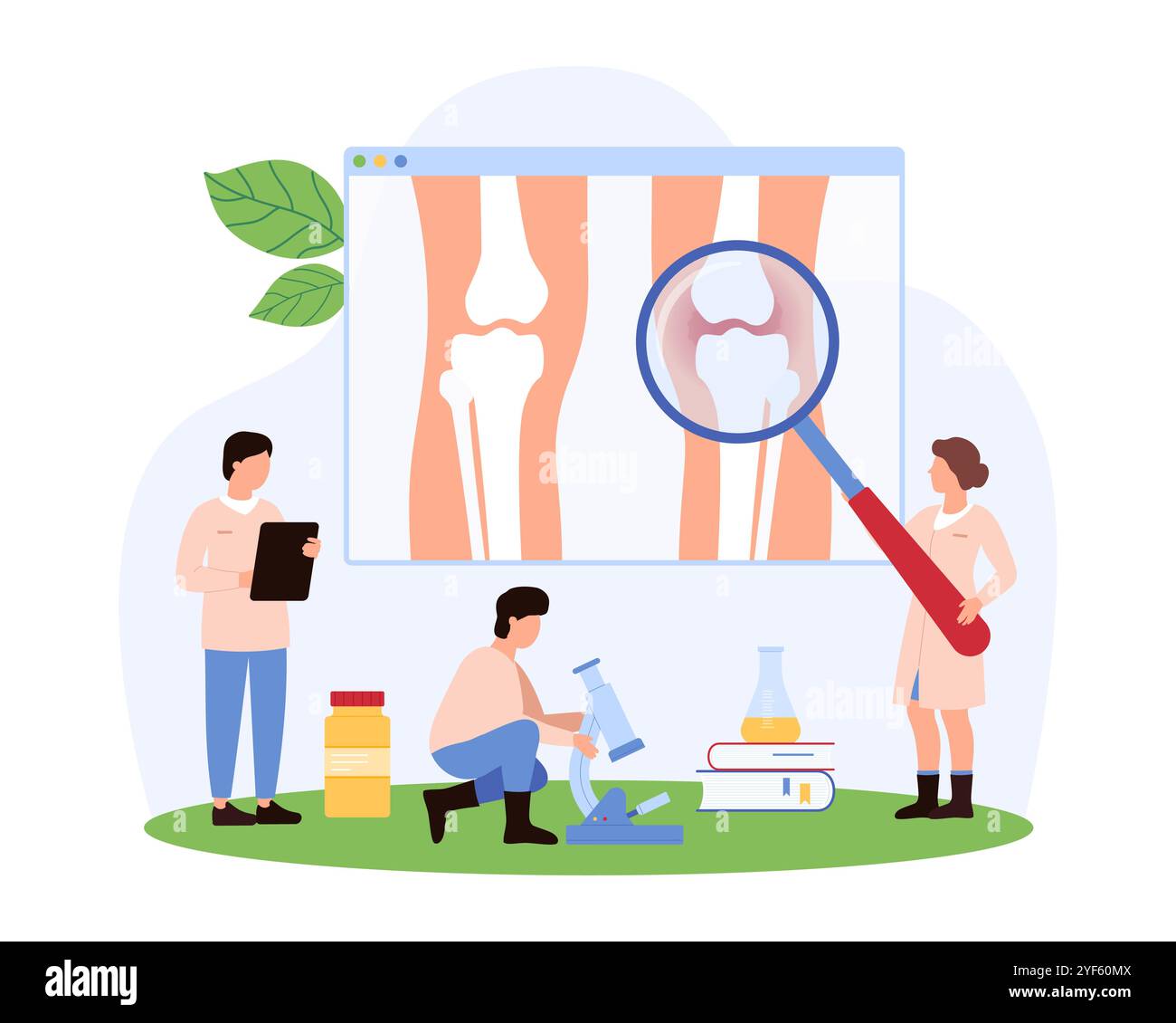 Doctors examining knee joint arthritis using X-ray, magnifying glass ...