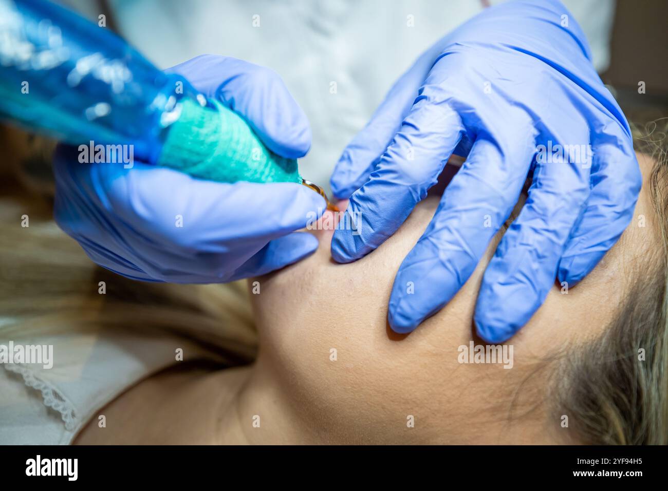 professional cosmetologist performing lip augmentation procedure on ...